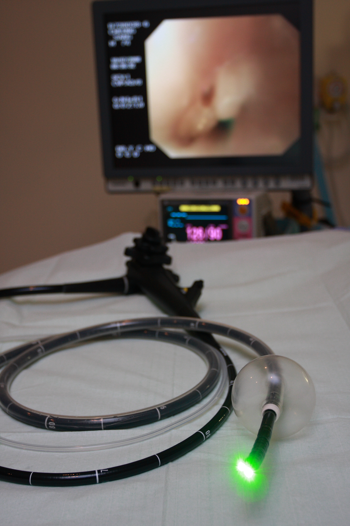 Union Hospital Endoscopy And Day Surgery Centre Union Hospital Endoscopy And Day Surgery Centre